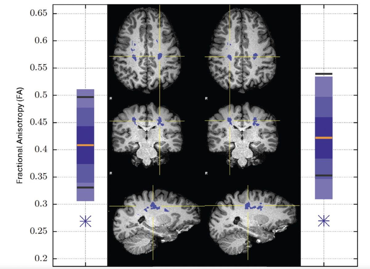 Translational Neuroimaging Lab – Columbia University Irving Medical Center
